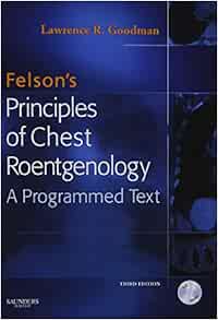 Amazon | Felson's Principles of Chest Roentgenology Text with CD-ROM ...