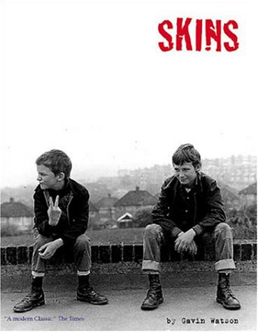 Amazon | Skins | Watson, Gavin | Popular Culture