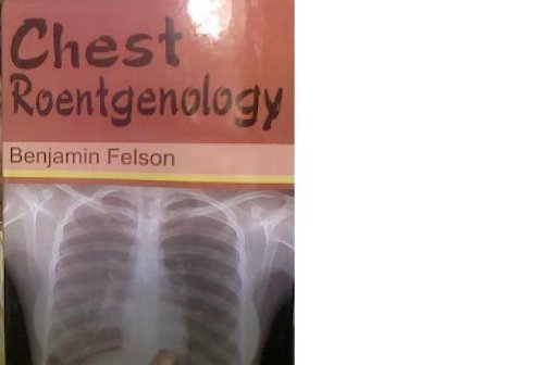 Amazon | Chest Roentgenology | Felson, Benjamin | Diagnostic Imaging
