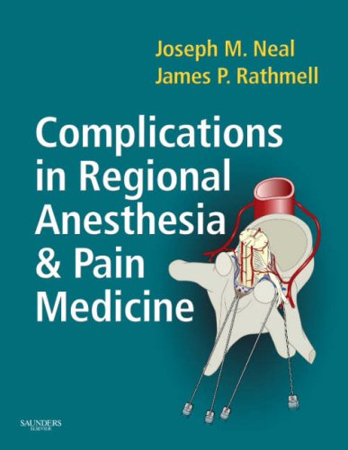 Amazon | Complications in Regional Anesthesia and Pain Medicine, 1e ...