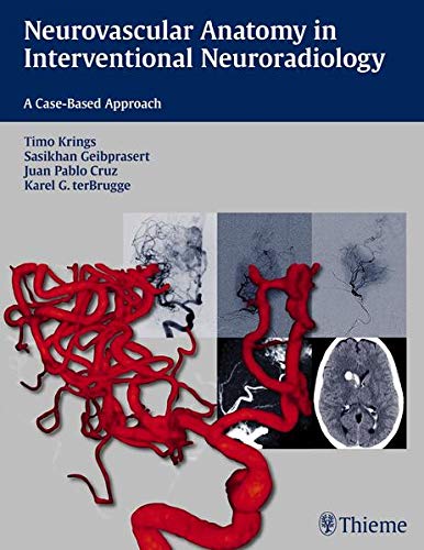 Amazon | Neurovascular Anatomy in Interventional Neuroradiology: A Case ...