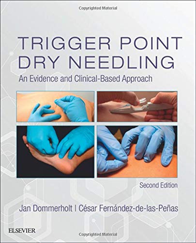 Amazon | Trigger Point Dry Needling: An Evidence and Clinical-Based Approach | Dommerholt PT DPT ...