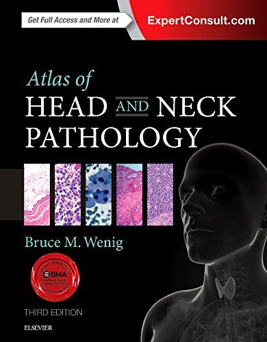 Amazon | Atlas of Head and Neck Pathology (Atlas of Surgical Pathology ...