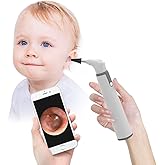 Wireless Otoscope Ear Camera with Dual View, 3.9mm 720PHD WiFi Ear ...