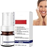 Aobenz Serum, Aobenz Spot Remover Serum, Aobenz Whitening and Freckle ...