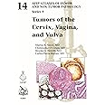 Amazon | Tumors of the Cervix, Vagina, and Vulva (AFIP Atlas of Tumor and Non-Tumor Pathology ...