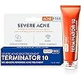 AcneFree Terminator 10 Acne Spot Treatment with Benzoyl Peroxide 10% ...